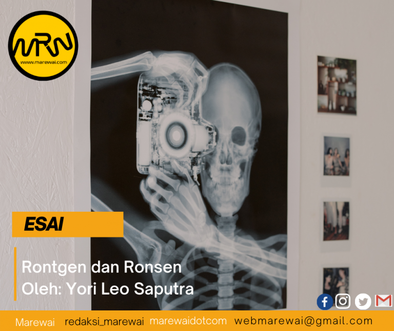 Yori Leo Saputra | Rontgen dan Ronsen - Redaksi Marewai